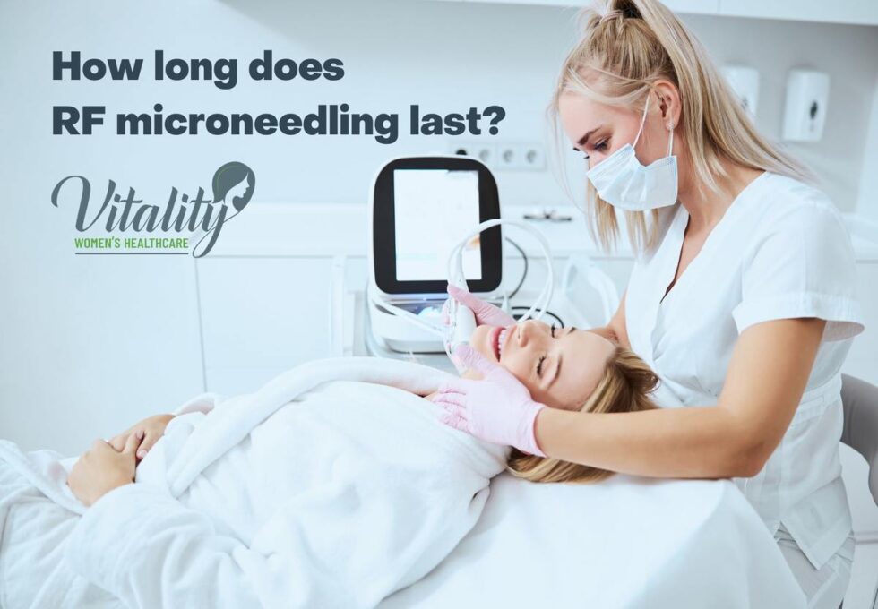 How Long Does RF Microneedling Last?