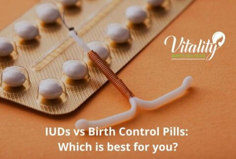 IUDs vs Birth Control Pills: Which is Best For You?